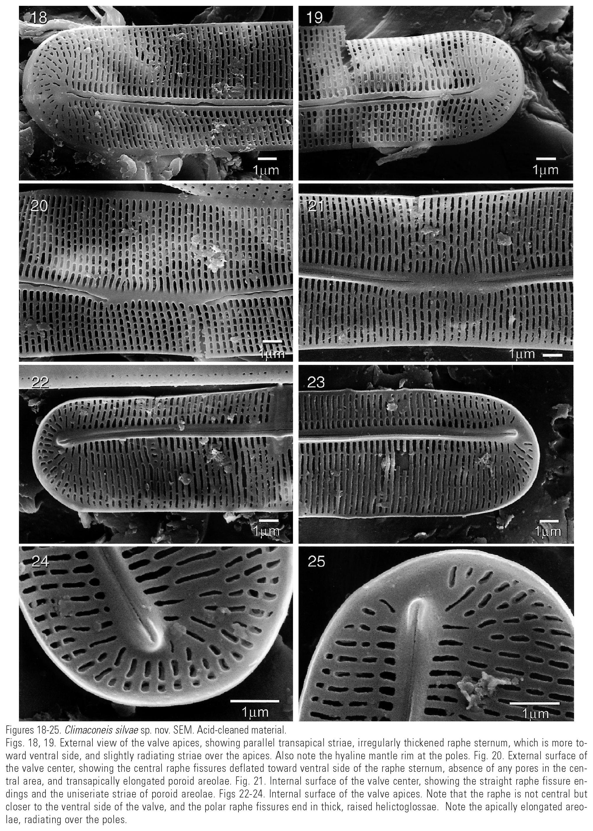 Fine structure and taxonomy of two species of the marine diatom genus ...