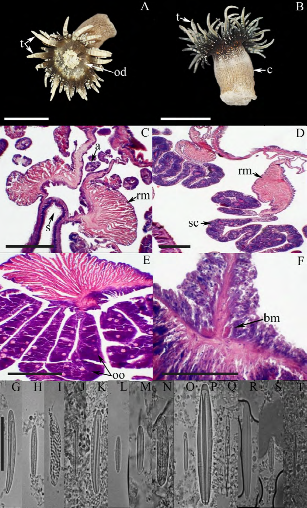 Sea anemones (Anthozoa: Actiniaria) from the coast of Yucatán, Mexico