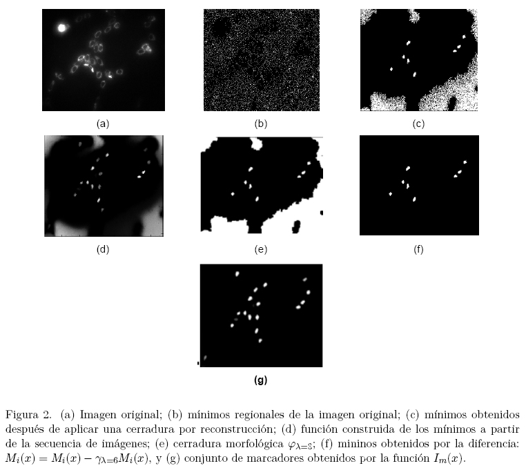Análisis de la variación del calcio intracelular en células foliculares