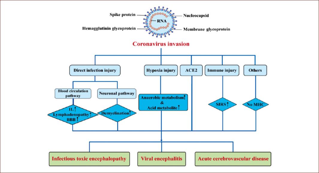 COVID-19 and Guillain-Barré Syndrome: A fortuitous relationship?