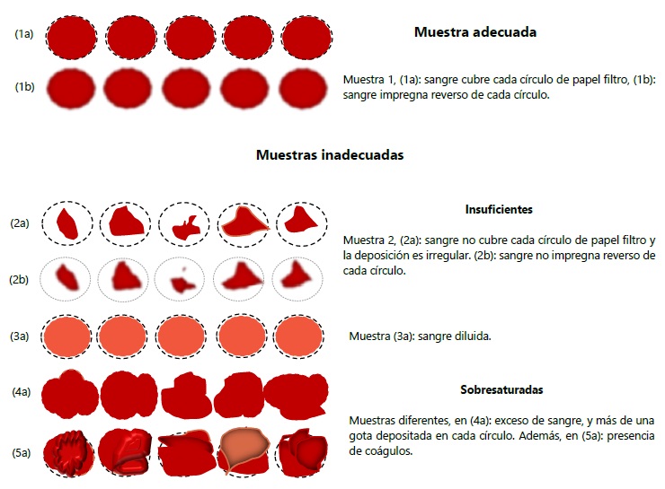 Intervención de enfermería en tamiz metabólico neonatal: Revisión integrativa
